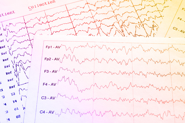 Continuous EEG Monitoring - Neural Wave Connections